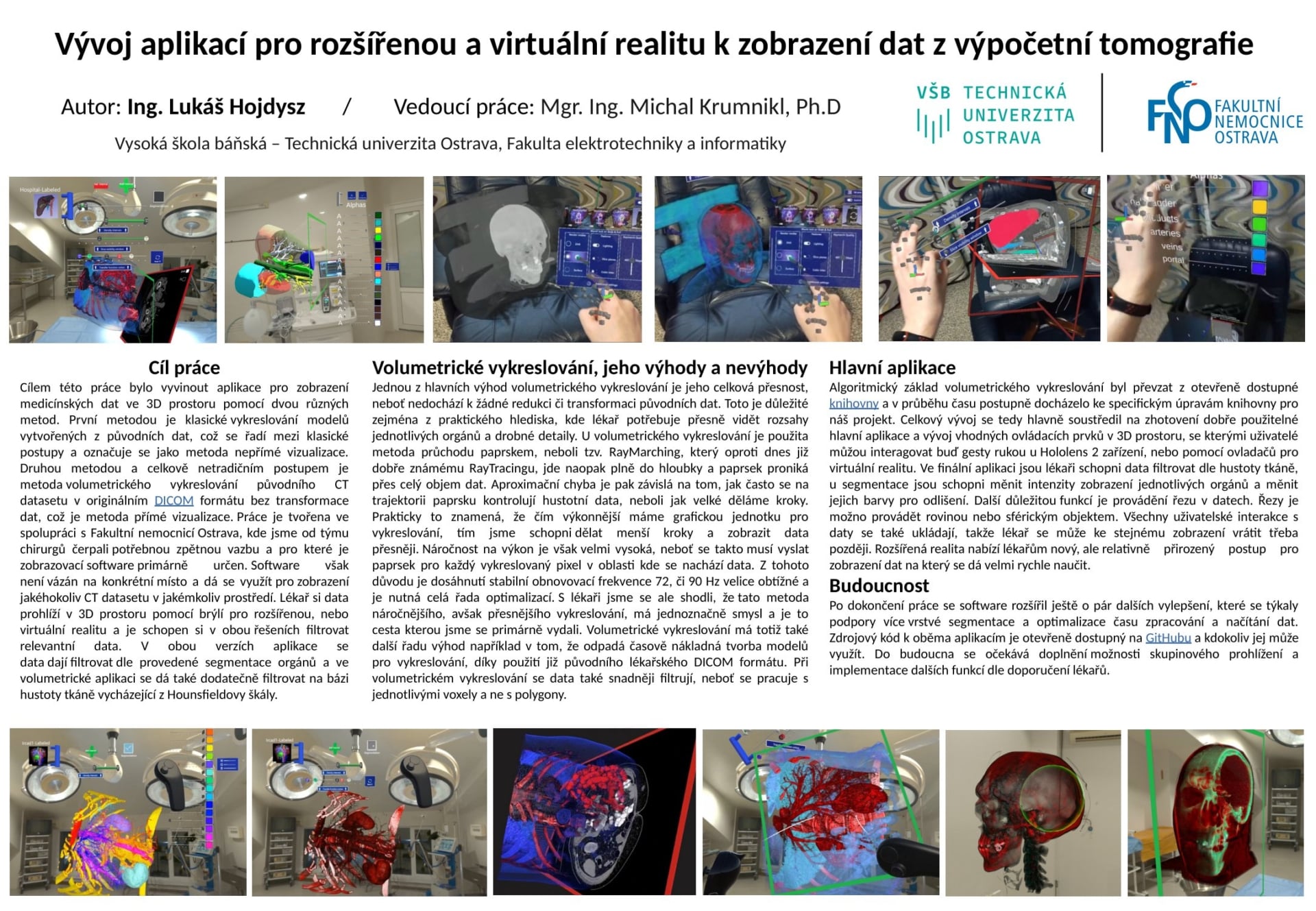 Using Augmented Reality to Visualize 3D Medical Images | IT SPY